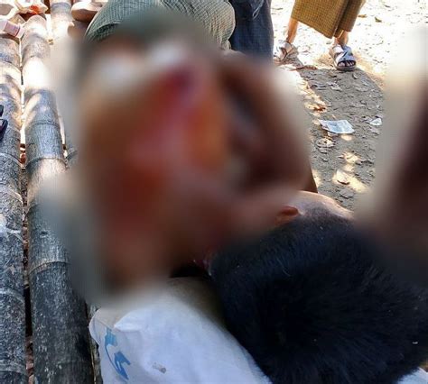 ကျောက်တော်မာ နယ်ချဲ့အကြမ်းဖက် စစ်ကောင်စီတပ်ဗုံးကြဲ လို့ အချေတယောက်အပ