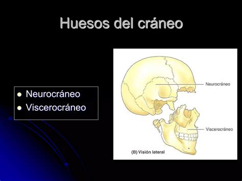 Apresentation Huesos Neurocraneo Y Viscerocraneo Ppt