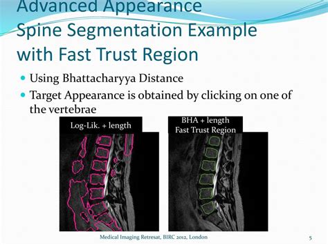 Advanced Appearance And Shape Models Ppt Download Advanced Appearance And Shape Models Ppt Download