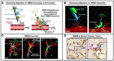 Figure 1 From The Role Of The Tumor Microenvironment In Tumor Cell Intravasation And