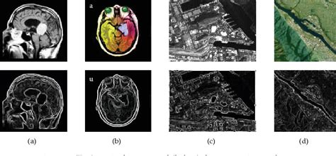 figure 1 from image segmentation using gray scale morphology and marker