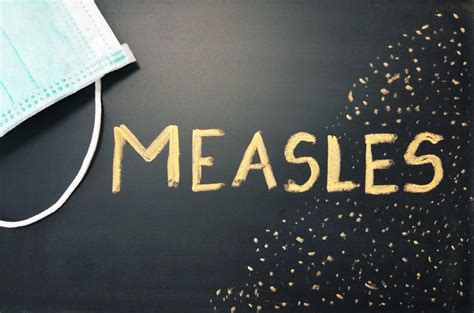 Measles Cases Are Rising 7 Things To Know About The Returning Killer