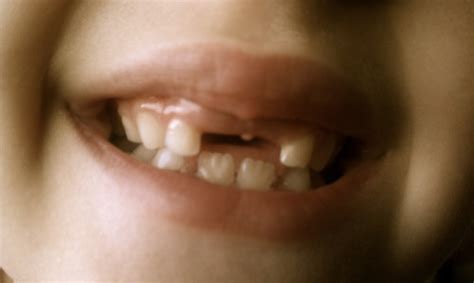 Age At Death Developmental Epiphyseal Fusion Bone Growth And Teeth Flashcards Quizlet