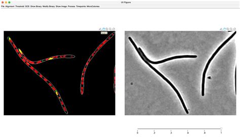 Bacteria Cell Segmentation For E Coli Research At Umass Matlab