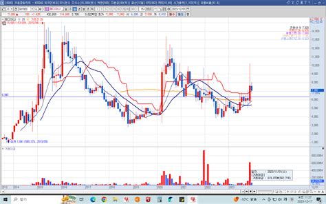 메디아나 주가 전망 셀바스 Ai 인수 의료기기 관련주 매매전략