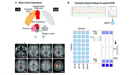 Procedures For Parametric Empirical Bays Peb Effective Connectivity