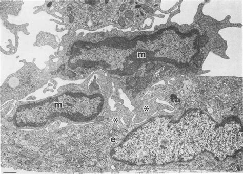 Transmission Electron Micrograph Of Two Adherent Monocytes M In The