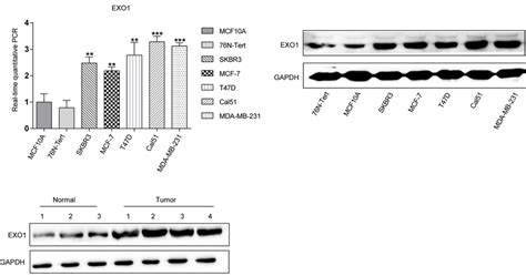 Exo1 Expression Verification In Cell Lines And Tissues A Mrna