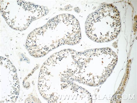 Bdnf Antibody 25699 1 Ap Proteintech