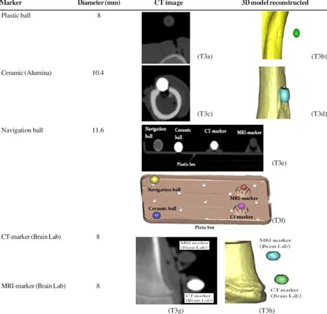 The Ct Images And Ct Derived Models Of The Fiducial Markers Download Scientific Diagram