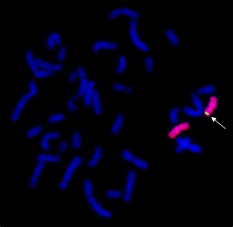 Metaphase Spread With A Translocation Between X And Y Chromosomes Download Scientific Diagram