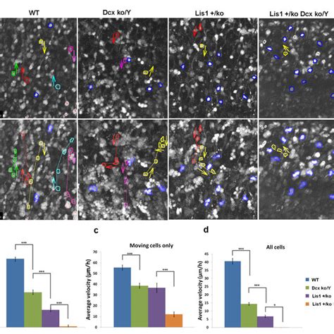 Summary Of Neuronal Migration And Neurogenesis Defects Found In Single Download Scientific