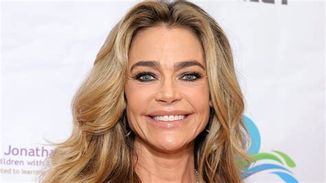 Denise Richards Muestra El Antes Y El Después Tras Hacerse Un Lifting
