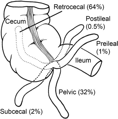 Anatomy Of The Appendix