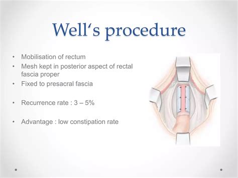Rectal Prolapse D1 Pptx