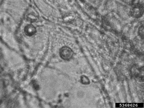 Pythium Diseases Genus Pythium