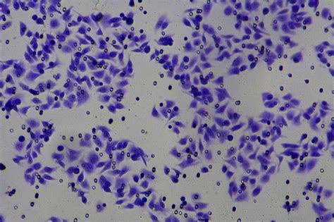 Transwell侵袭、迁移实验 湖南慧登生物科技有限公司