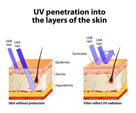 Radiazione ultravioletta (UV) - AIM presso Melanoma Foundation