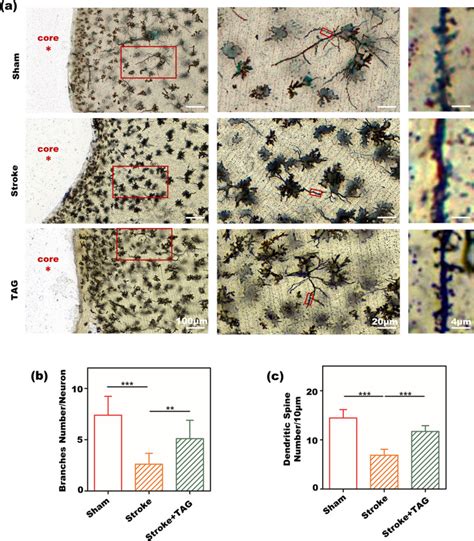 Nanoarchitectonics Of Tannic Acid Based Injectable Hydrogel Regulate The Microglial Phenotype To