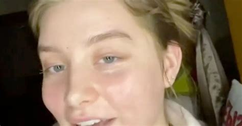 Dont Do Viral Slugging Routine If You Have This Common Skin Problem Doctors Warn The Mirror Us