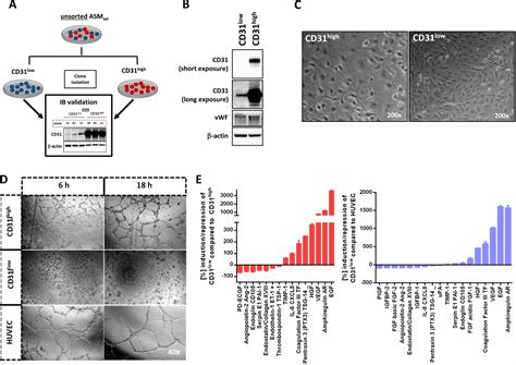 Cd31 Expression Determines Redox Status And Chemoresistance In Human