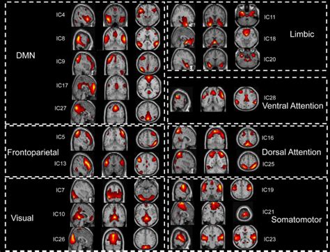 Ability Of An Altered Functional Coupling Between Resting State Networks To Predict Behavioral