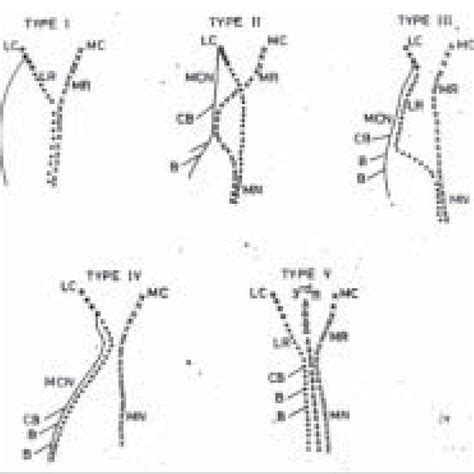 Figure Shows Variation Types Of Lee Minors Classification Lr