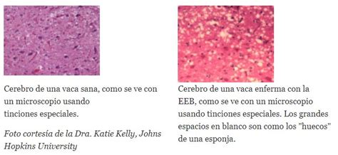 Qué Es El Mal De La Vaca Loca Y Cómo Puede Afectar A Los Humanos Infobae