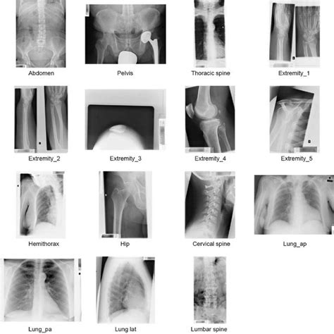 Examples Of X Ray Images Used In The Tests Download Scientific Diagram