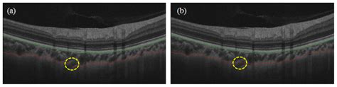CSI Segmentation Comparison Between The Original Method And The Download Scientific Diagram