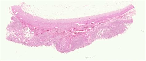 Duodenum Flashcards Quizlet
