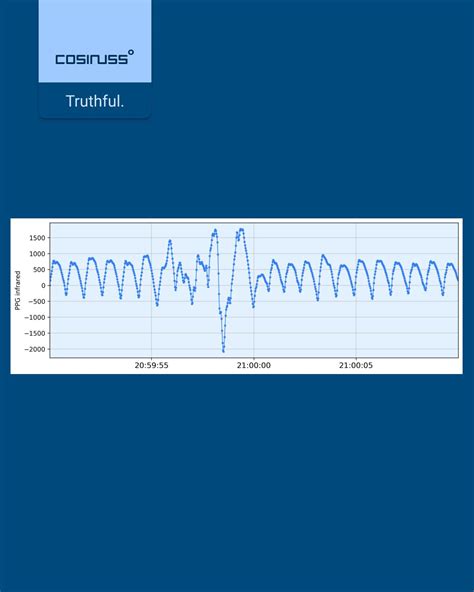 📈 The Ppg Curve Offers A Wealth Of Information For Health Professionals But First Of All It
