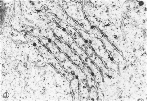 Parallel Cisterns Of The Rough Endoplasmic Reticulum Between Which Download Scientific