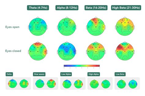 Qeeg Brain Mapping Myndlift