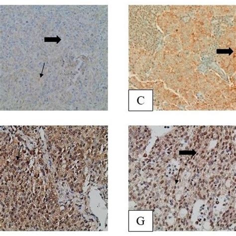 Immunohistochemical Expression Of Yap Taz Tead4 And Lats1 In The
