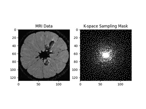 3d Neuroimaging Cartesian Reconstruction — Pysap V0 2 1