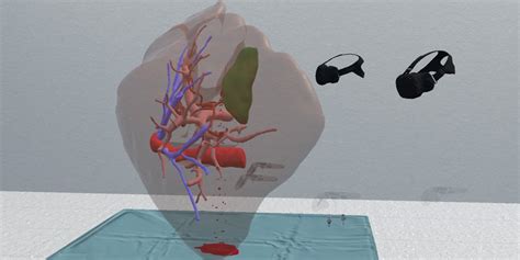 Two Surgeons Are Performing The Surgery Mode Of Laparoscopic Setting Download Scientific