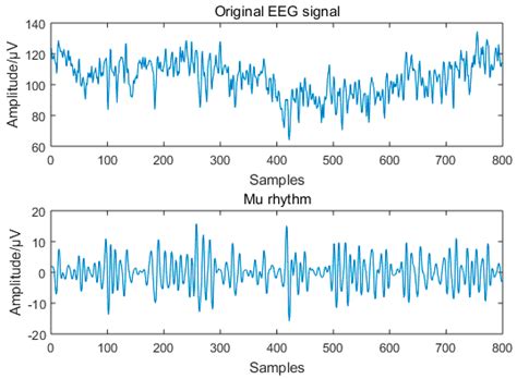 Electronics Free Full Text Eeg Feature Extraction Based On A