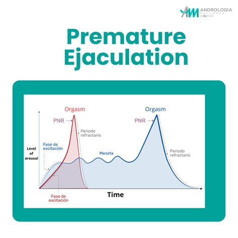 Premature Ejaculation Andrología Barcelona