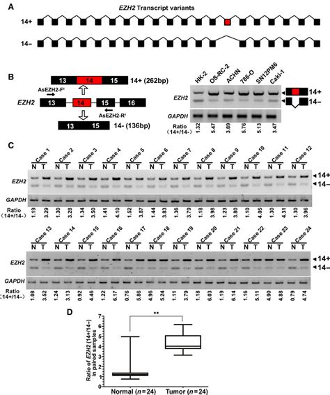 EZH2 Exon 14 Inclusion Is Upregulated In Renal Cancers A Schematic Download Scientific