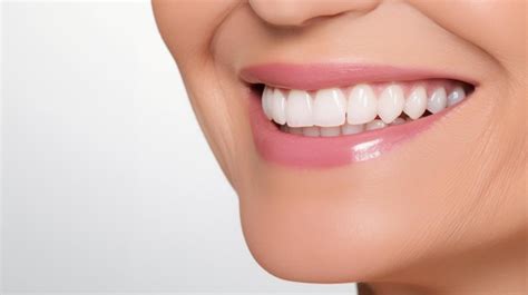 Beautiful Womans Smile With Healthy White Straight Teeth Closeup On
