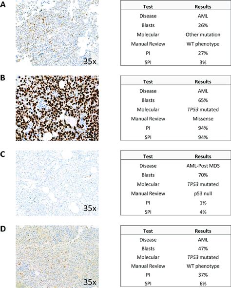 Sample Cases Representative Images With Corresponding Analyses A Wt Download Scientific
