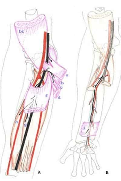 Compression Du Nerf Médian Au Coude Dr Houvet Spécialiste Des Nerfs