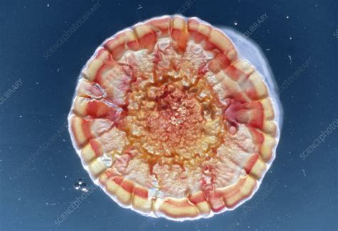 Colony Of Streptomyces Lividans Bacteria Stock Image B2400019