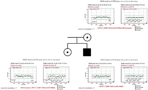 Deletion Of Exon 30 38 Deletions Of The Dmd Gene Was Identified In