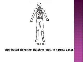 Cutaneous Mosaicisms Concepts Patterns And Classifications Dr