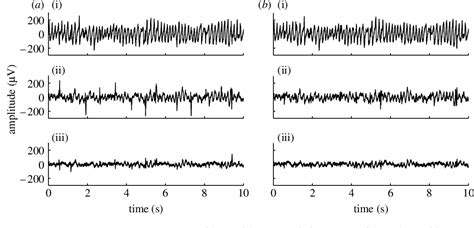 Figure 1 From Analysis Of Atrial Fibrillation From Electrocardiogram Signal Processing To