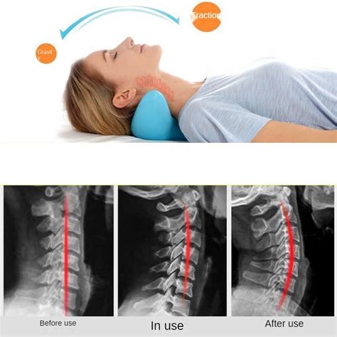 Cervical Spine Massage Pillow Gravity Acupressure Neck Massa Inspire