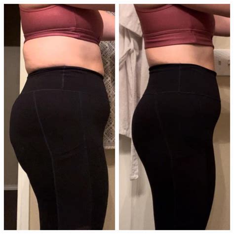 Ozempic Butt My A Rmounjaro