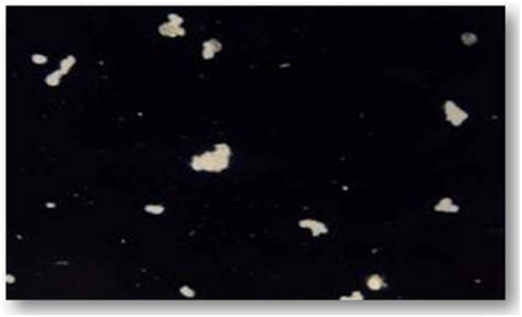 Positive Microscopic Agglutination Test Mat At A Titre Of 1 640 Download Scientific Diagram